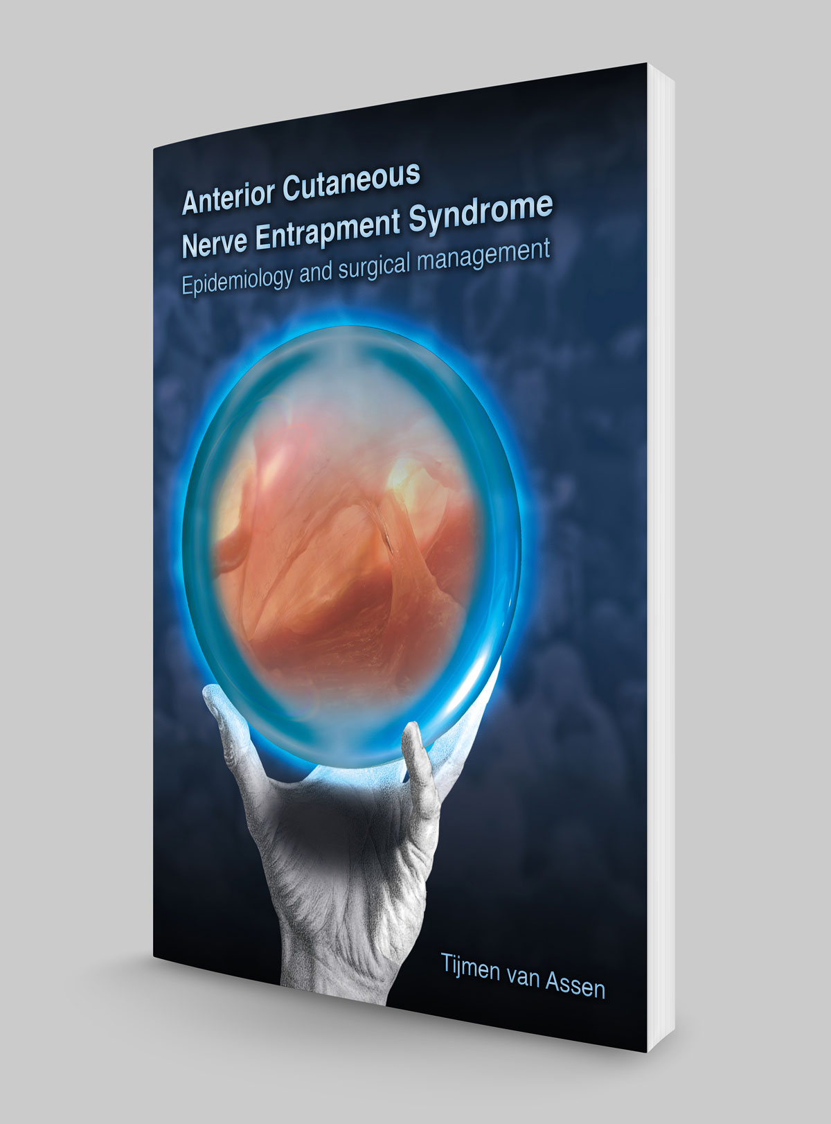 Acnes: Anterior Cutaneous Nerve Entrapment Syndrome - Mirakels Ontwerp